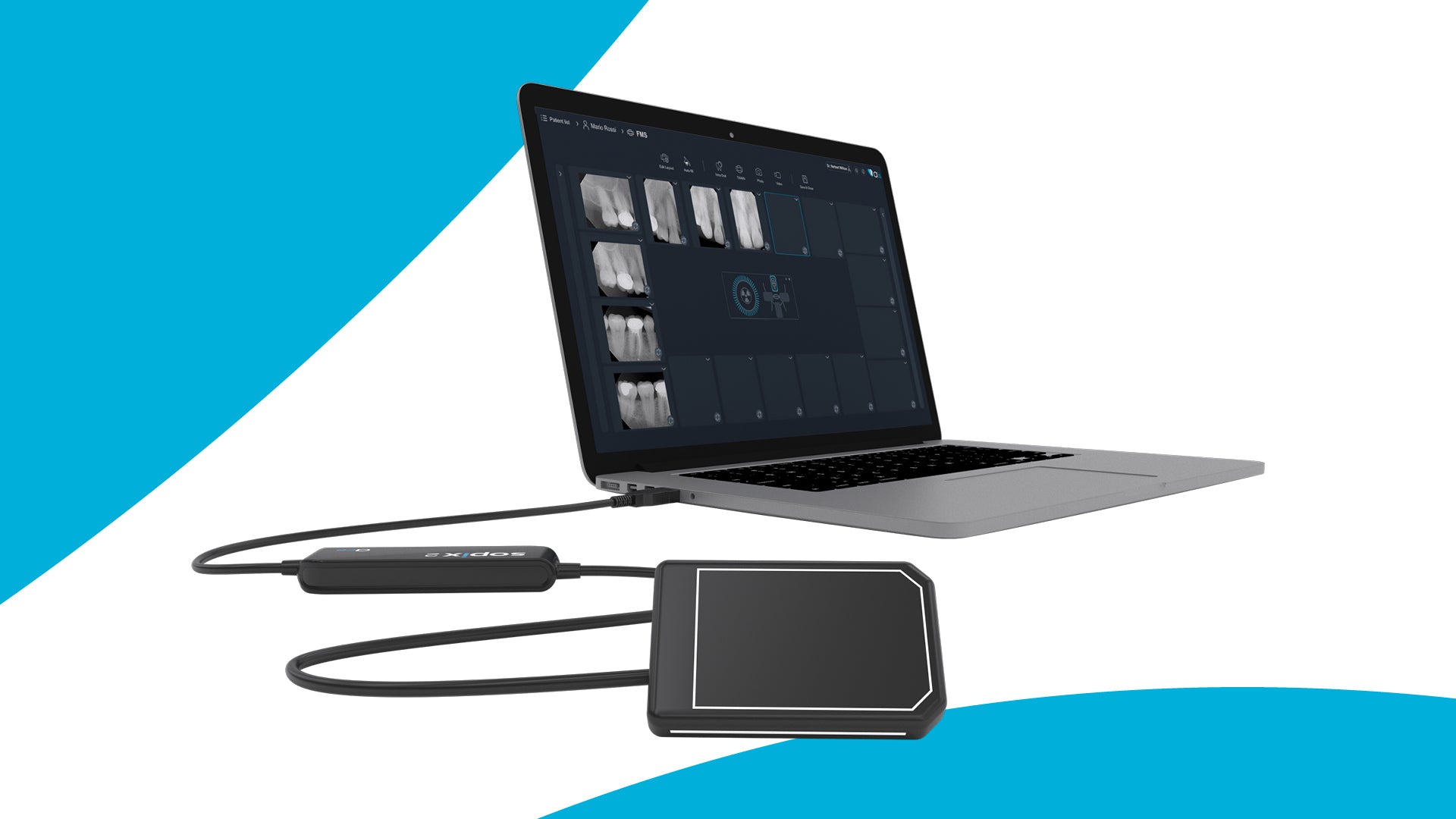 Acteon Sopix 2 Digital Intraoral X-ray Sensor – AIMSCY